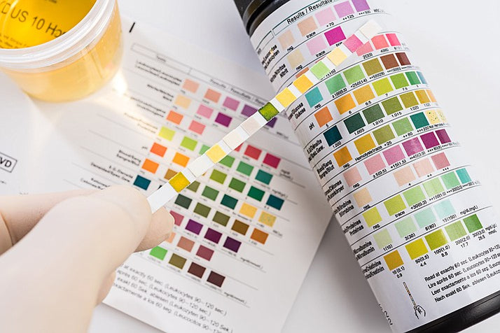 Knee Immobiliser Richard Splint Brace 60cm Length | QureMed